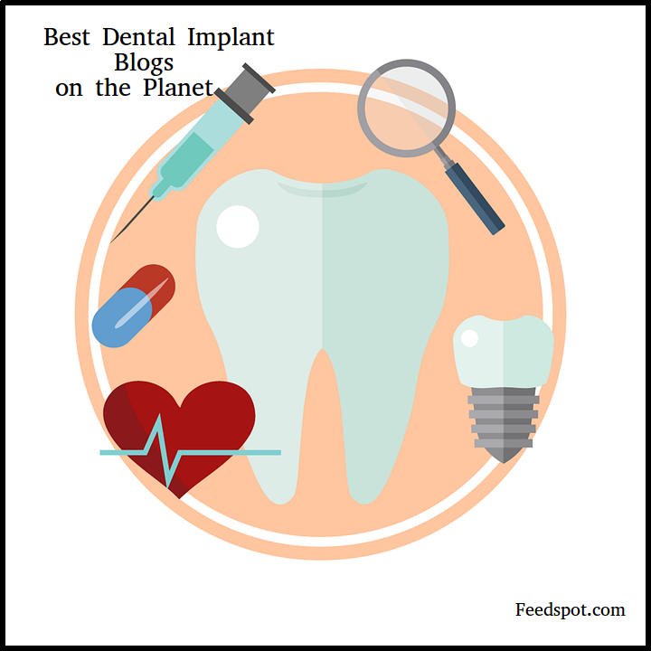 45 Best Dental Implant Blogs to Follow in 2026